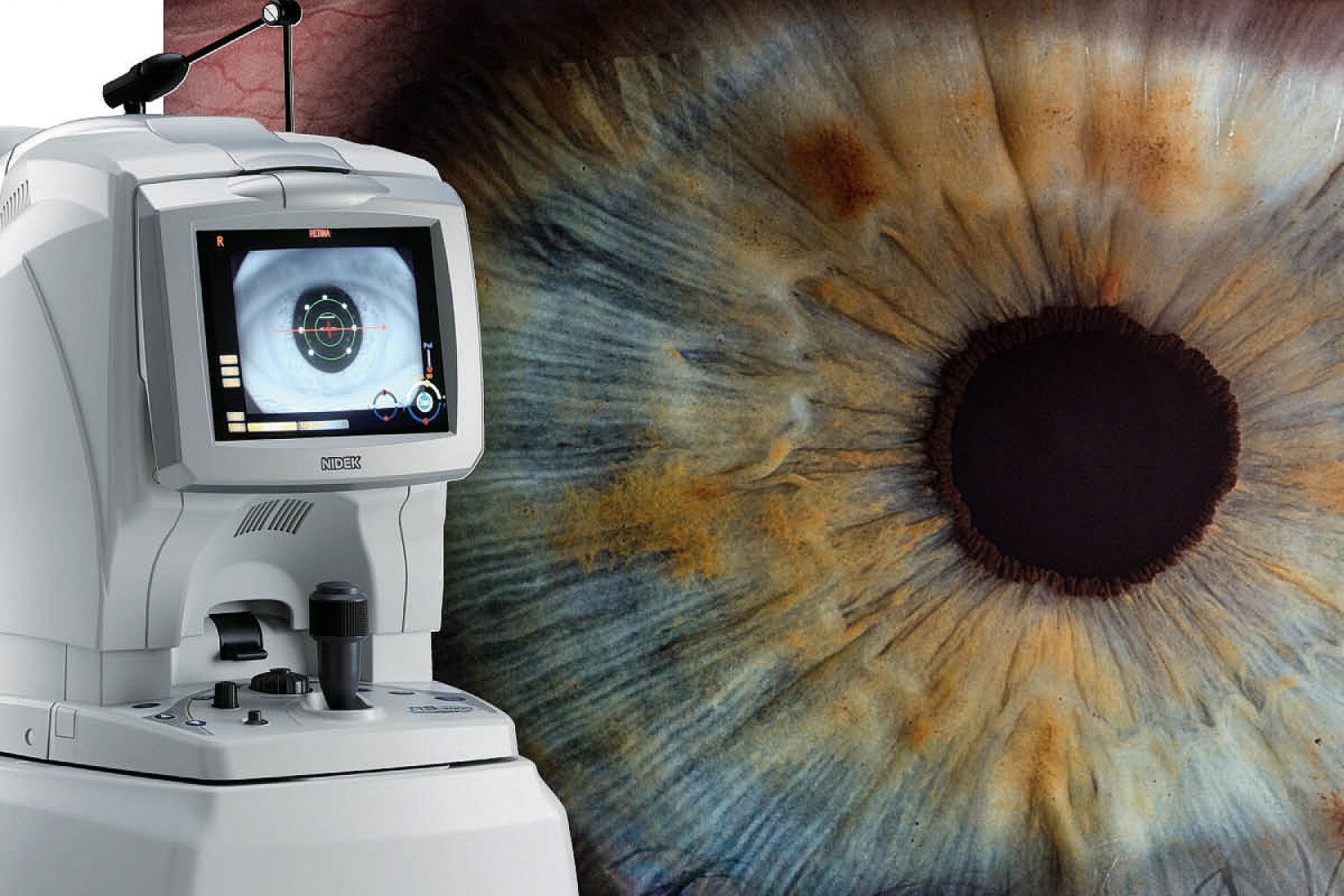 What Is an OCT Eye Exam? - The Optical Factory